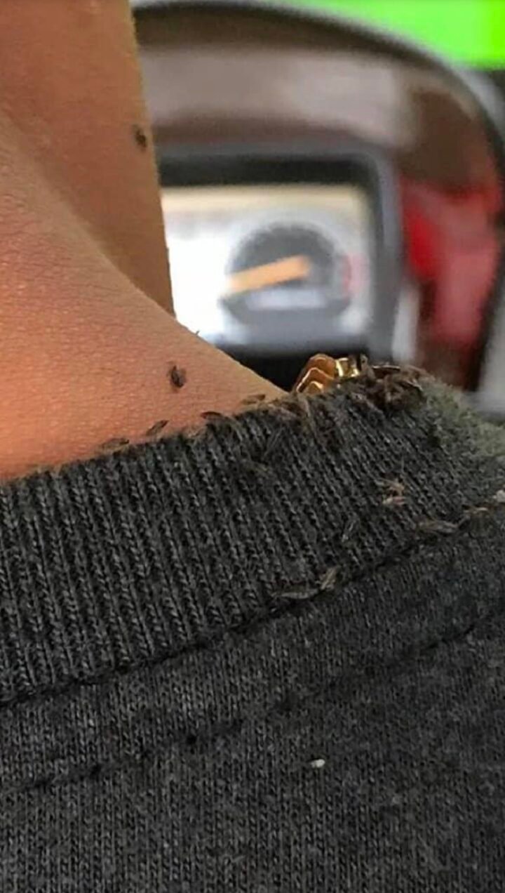 Man's Head Lice Horror Goes Viral – You Won’t Believe How Bad It Is ...