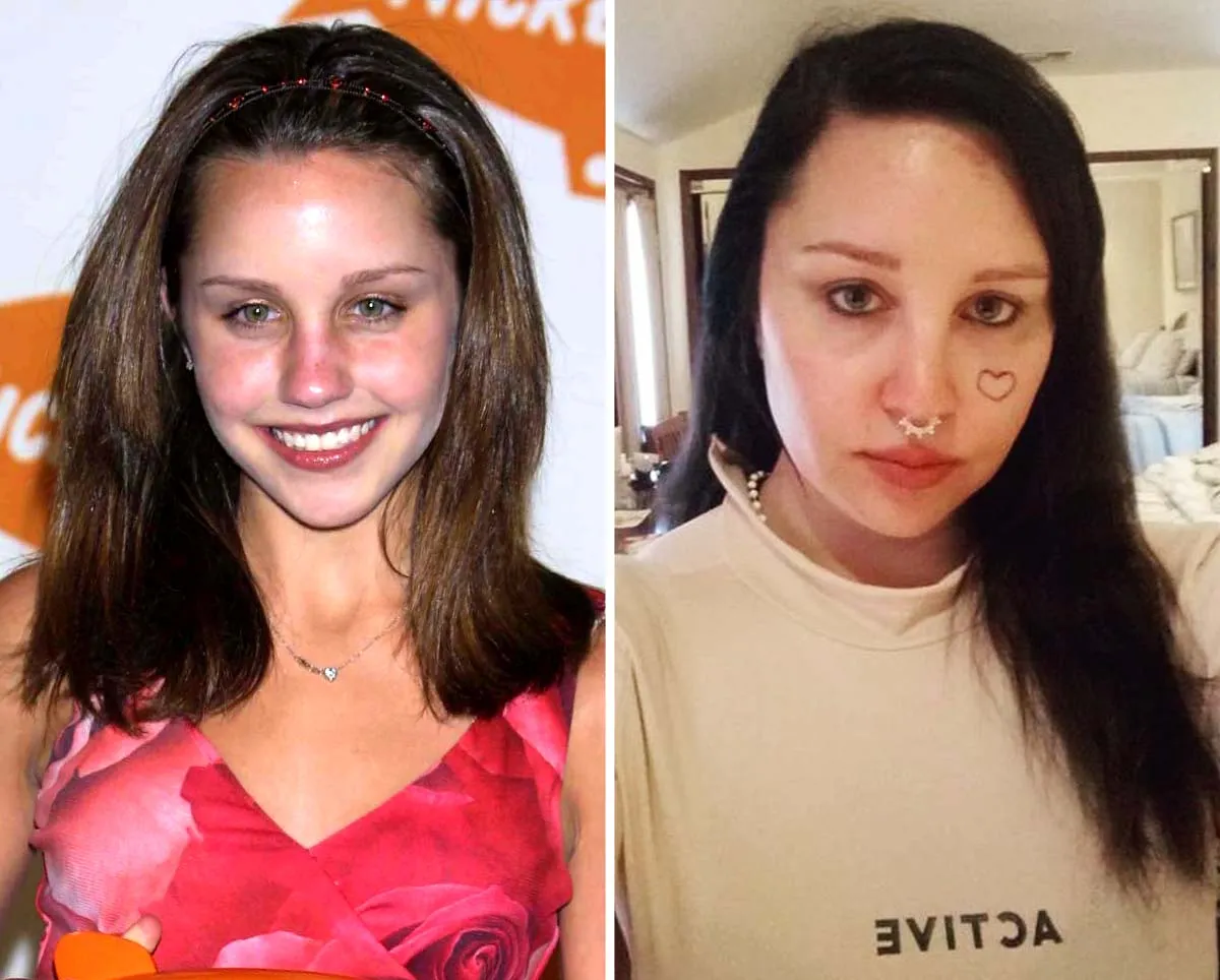 Amanda Bynes Then and Now: A Shocking Transformation - Jokes Daddy